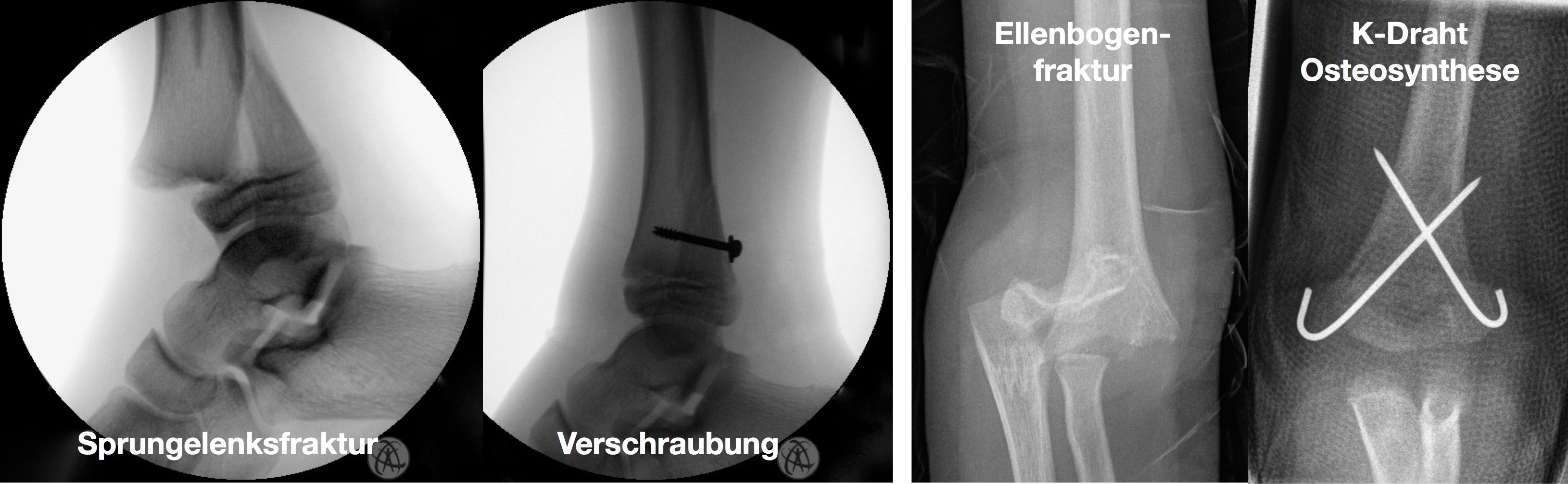 Traumatologie | Universitätsklinikum Tübingen